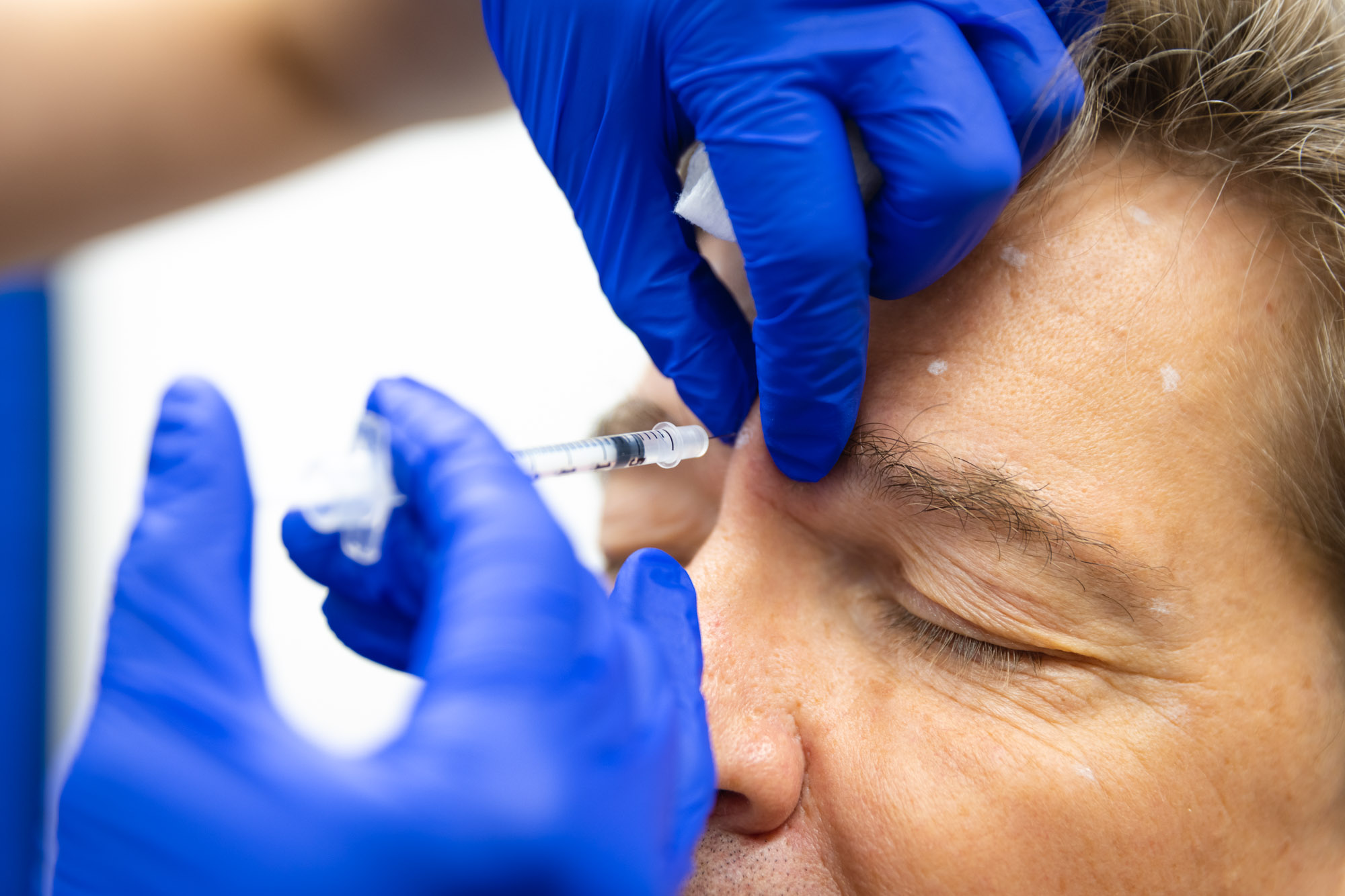 Your Botox Journey With A360 | Aesthetics 360